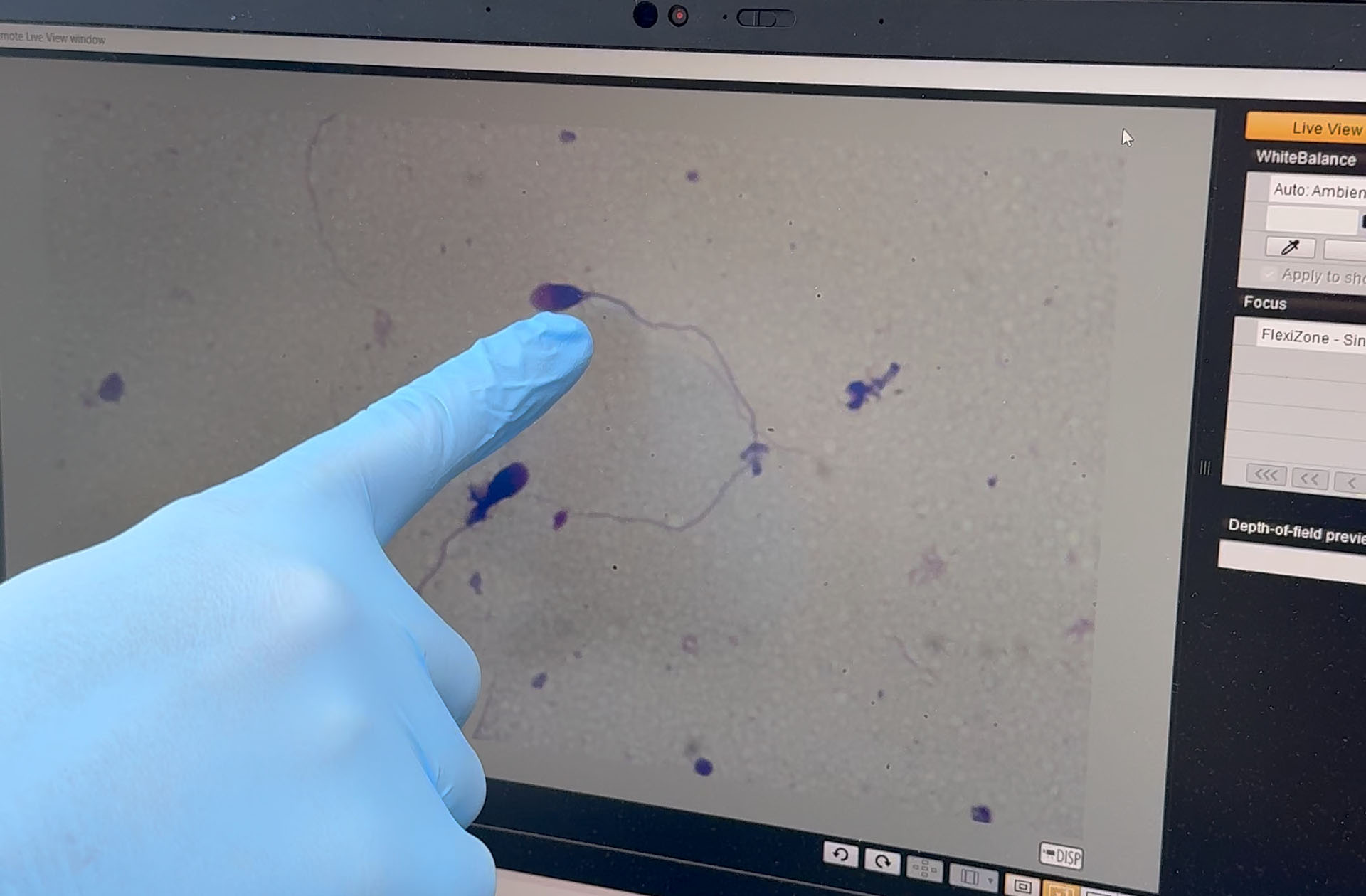 Post Vasectomy Sperm Test Post Vasectomy Semen Analysis Post 2307